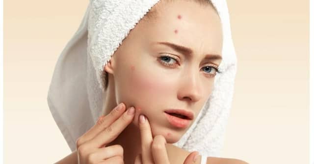 5 Rekomendasi Masker untuk Menghilangkan Beruntusan | Popmama.com