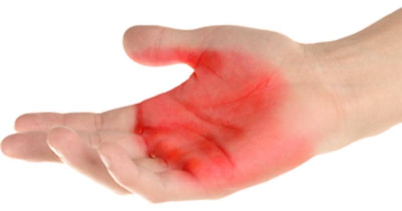 Pertolongan Pertama pada saat Anak Mengalami Luka Bakar | Popmama.com