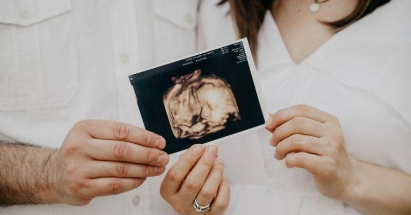 USG 4D saat Hamil, Sebaiknya di Usia Berapa Minggu? | Popmama.com