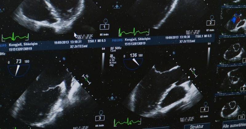 Mengenal Apa Itu Masa Gestasi dan Cara Menghitungnya | Popmama.com