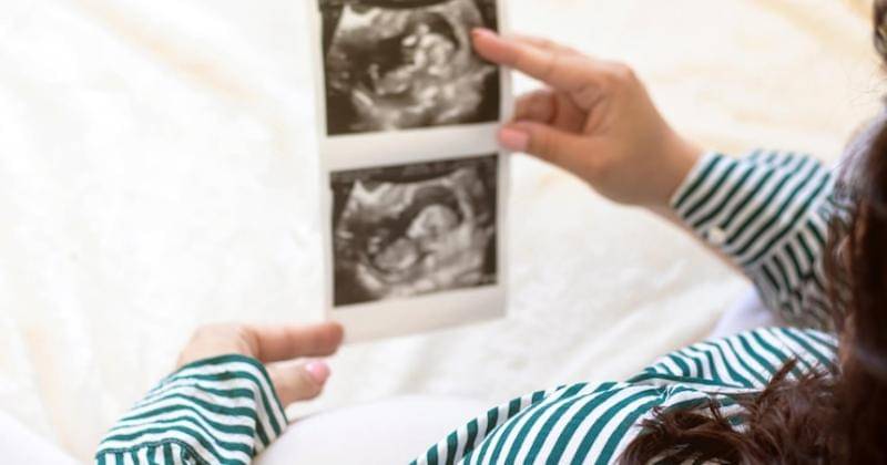 Plano Test Adalah Tes Kehamilan dengan 2 Metode Praktis | Popmama.com