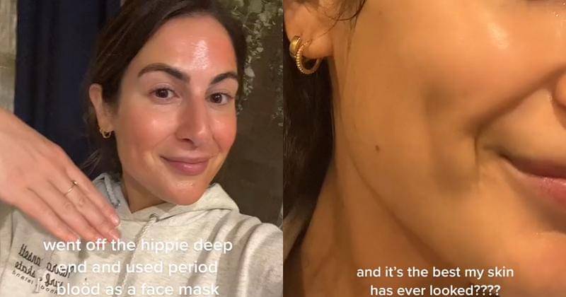 Viral Maskeran Pakai Darah Haid Bikin Wajah Glowing | Popmama.com