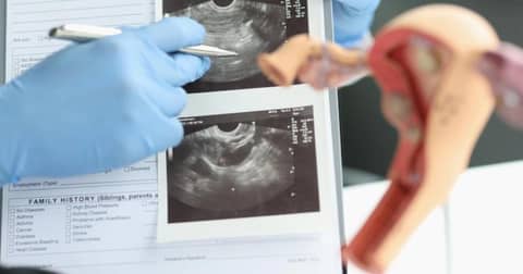 9 Organ Reproduksi Wanita dan Fungsinya, Penting Diketahui | Popmama.com