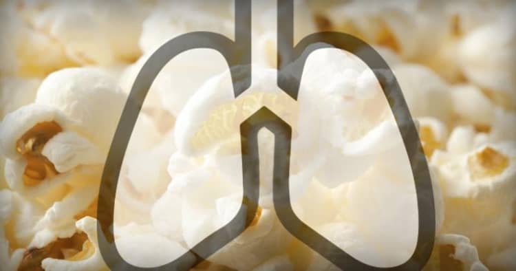 Popcorn Lung Penyakit Paru Akibat Vape atau Rokok Elektrik | Popmama.com