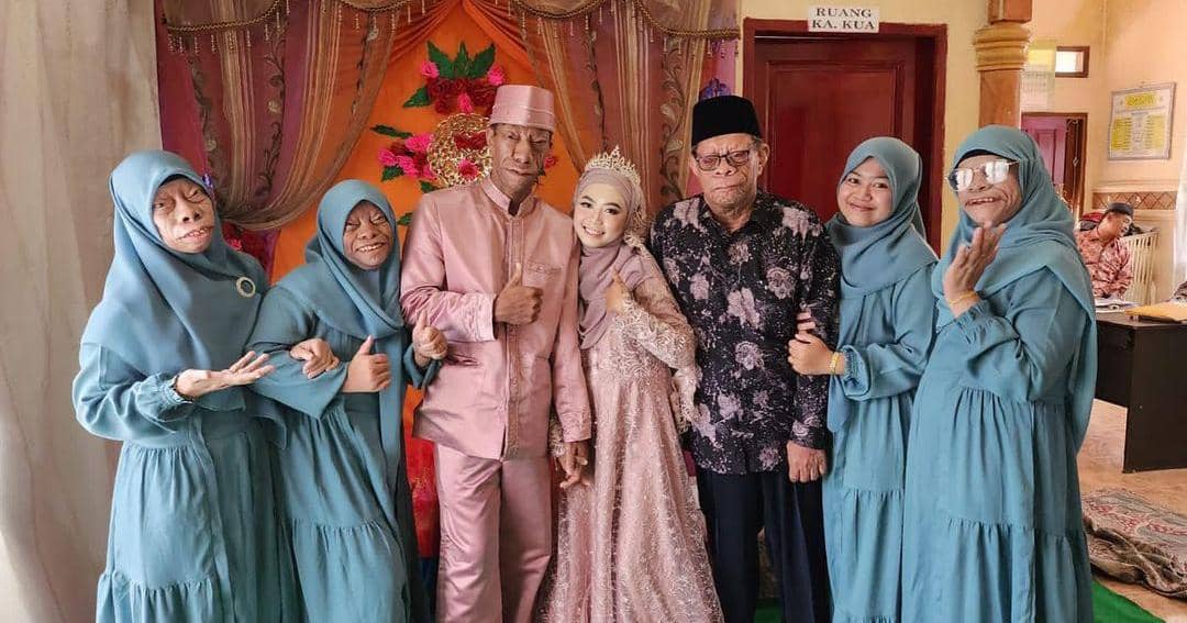 6 Fakta Keluarga Surya Manurung, Mengidap Sindrom Langka | Popmama.com