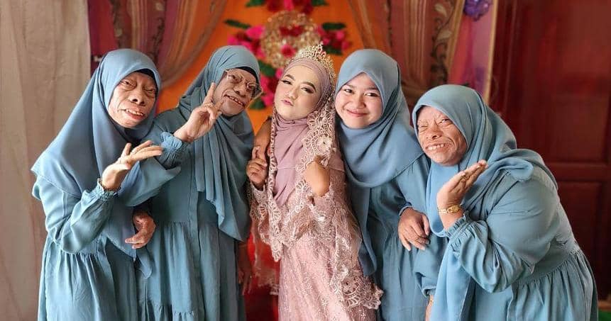 6 Fakta Keluarga Surya Manurung, Mengidap Sindrom Langka | Popmama.com