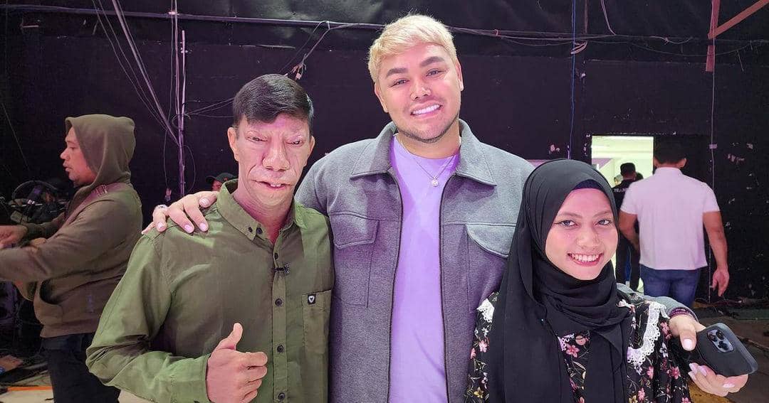 6 Fakta Keluarga Surya Manurung, Mengidap Sindrom Langka | Popmama.com