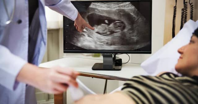 Kapan Ibu Hamil Harus USG fetomaternal? | Popmama.com
