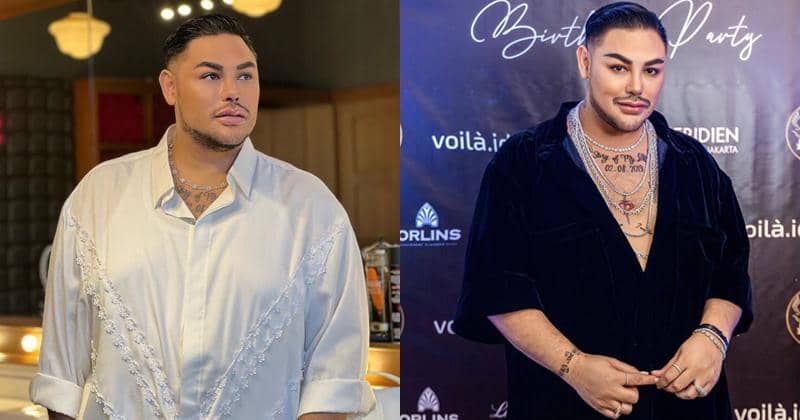 9 Foto Wajah Baru Ivan Gunawan setelah Operasi Plastik | Popmama.com