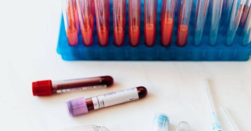 Mengenal Apa Itu Hemoglobin dan Kadar Normalnya | Popmama.com