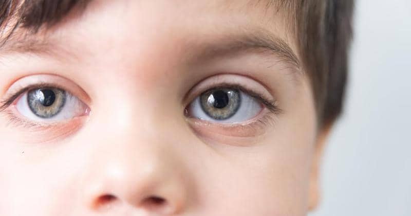 Tremenza Sirup untuk Anak: Dosis, Manfaat, dan Efek Samping | Popmama.com
