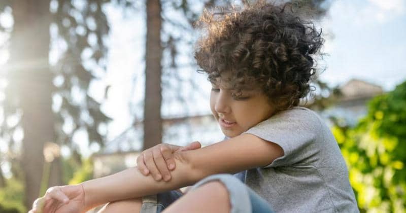 8 Cara Mengurangi Efek dan Mencegah Kaligata | Popmama.com