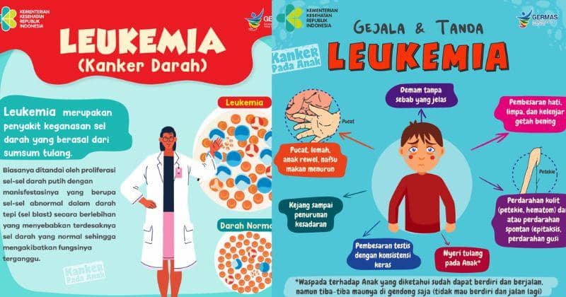 Leukimia pada Anak: Penyebab, Gejala, dan Pengobatan | Popmama.com