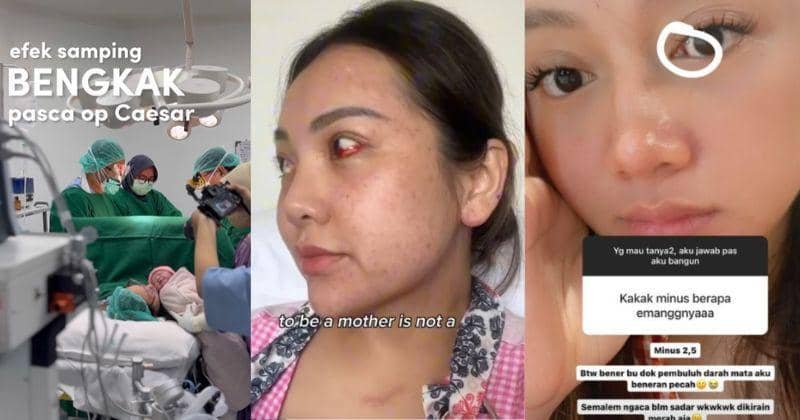 7 Cerita Artis Alami Masalah Kesehatan usai Melahirkan | Popmama.com