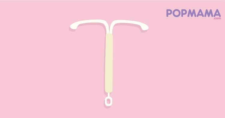 Perbedaan IUD Tembaga dan IUD Hormonal, Bagus yang Mana? | Popmama.com