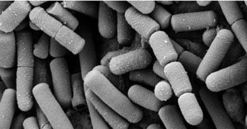 Apa Itu Bakteri Bacillus Cereus? | Popmama.com