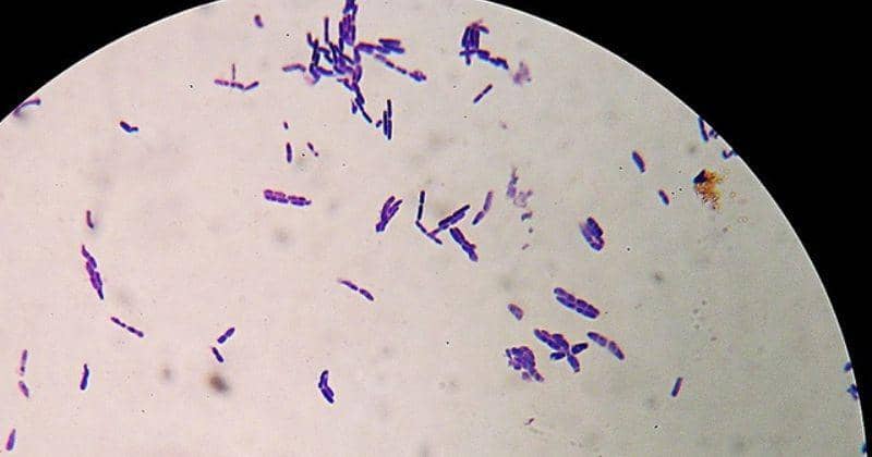 Apa Itu Bakteri Bacillus Cereus? | Popmama.com