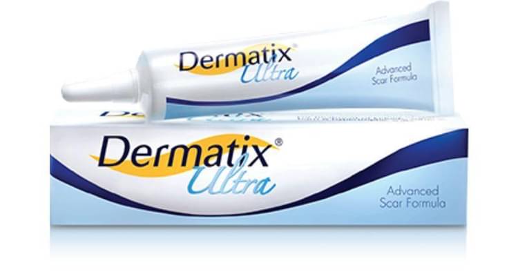 7 Salep Keloid dan Harga, Simak Penjelasannya! | Popmama.com