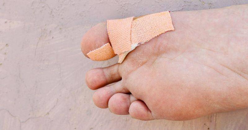 6 Penyebab Jempol Kaki Bengkak dan Cara Mengatasinya! | Popmama.com