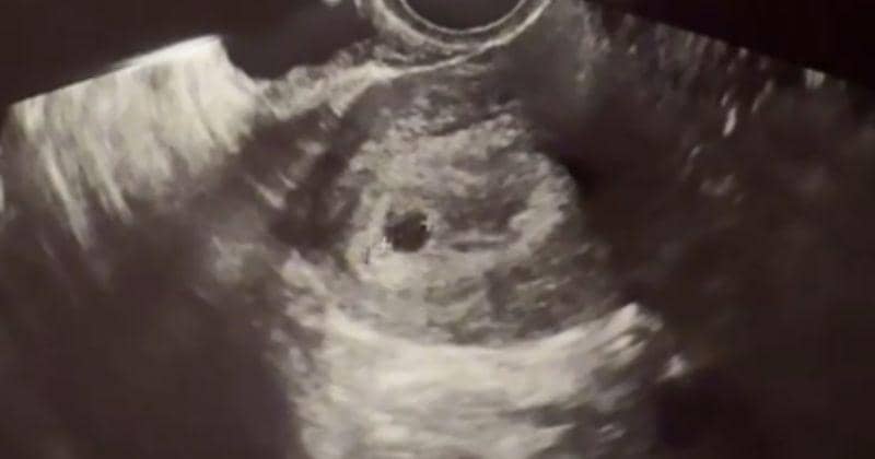 Jung Yoon Hye Rainbow Umumkan Kehamilan usai 4 Bulan Menikah | Popmama.com