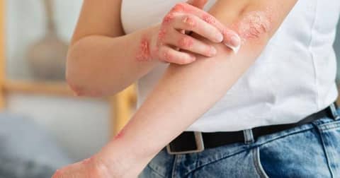 15 Penyebab Dubur Gatal dan Cara Mengatasinya | Popmama.com