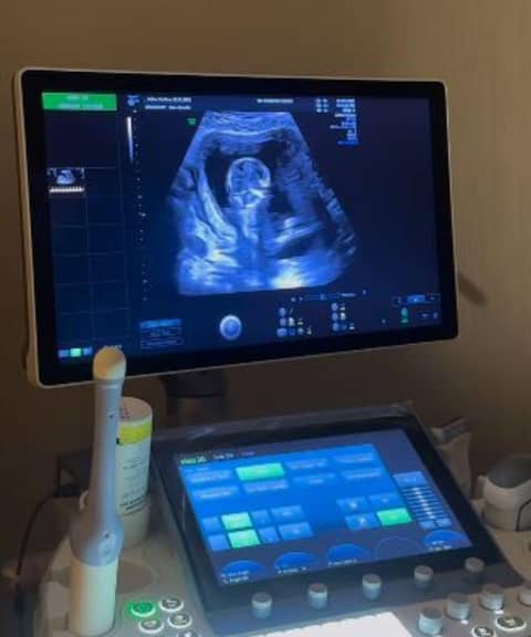 Ada Wajah Anaknya, Ini 7 Foto Erika Carlina Periksa USG | Popmama.com