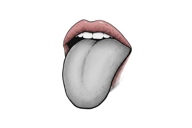 7 Warna Lidah Bisa Ungkap Kondisi Kesehatan, Waspadai Tanda Ini ...