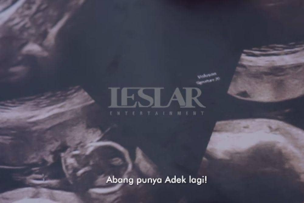 Cerita Lesti Kejora saat Tahu Hamil Anak Ketiga, Akui Sempat Khawatir ...